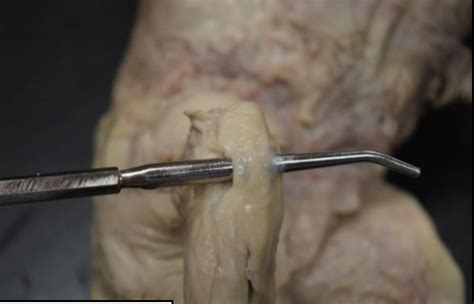 Lab Pictures Labeling Flashcards Quizlet