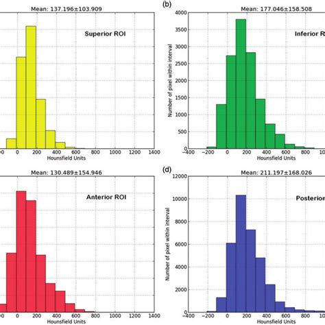 example of histograms showing the distribution of attenuation values in