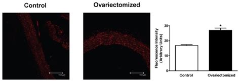 Confocal Micrographs Showing In Situ Detection Of Superoxide Anion In