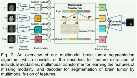 【论文阅读笔记】multimodal Transformer Of Incomplete Mri Data For Brain Tumor Segmentationmmformer网络结构