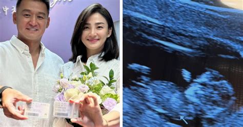 洪小鈴登記結婚！ 嫁張天霖「雙喜臨門」 娛樂 Ctwant