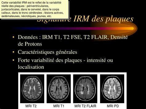 PPT Segmentation d IRM cérébrales multi séquences et application à