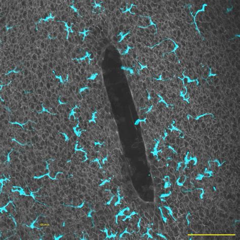 Immune Cell Response To A Scratch In The Zebrafish Epidermis Nikon
