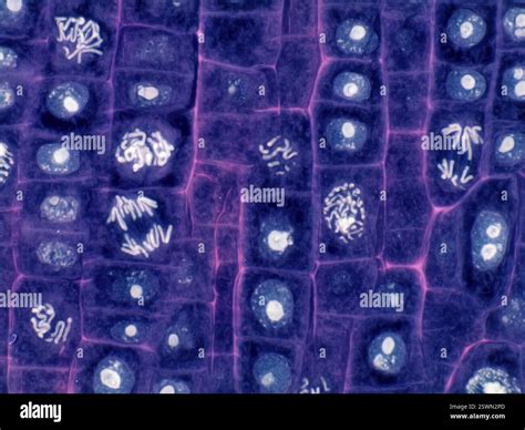 Plant Cell Mitosis Light Micrograph Of Root Tip Cells From An Onion Allium Sp Undergoing