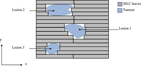 schematic diagram of an mlc with an aperture shaped to allow all three