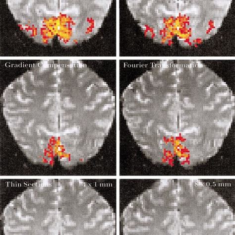 Activation Maps Of The Visual Cortex As In Fig 3 But For A Different Download Scientific