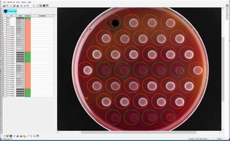 Biomic V3 Microbiology System Agar Dilution Giles Scientific Usa