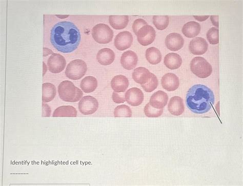 Solved Identify The Highlighted Cell Type Chegg