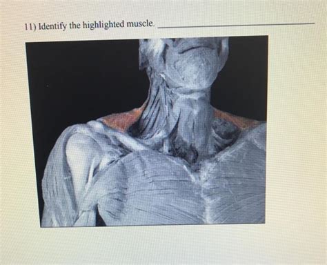 Solved Identify The Highlighted Muscle Identify Chegg