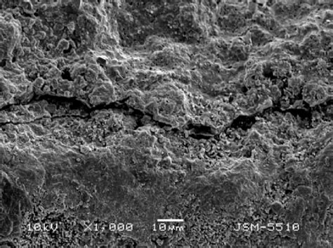 Marginal Adaptation Of Mta Sem ×1000 Magnification Download