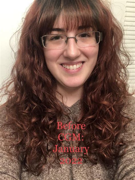 First Time Sharing My Cgm Journey R Curlyhair
