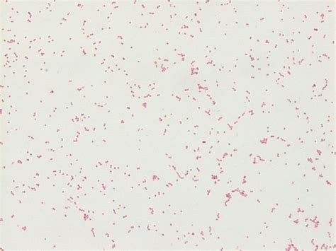 Gram Negative Cocci In Pairs Gram Positive Pneumonia Possibilities