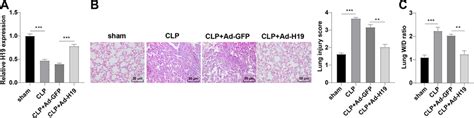 Overexpression Of Lncrna H19 Attenuates Sepsis Induced Ali The C57bl6