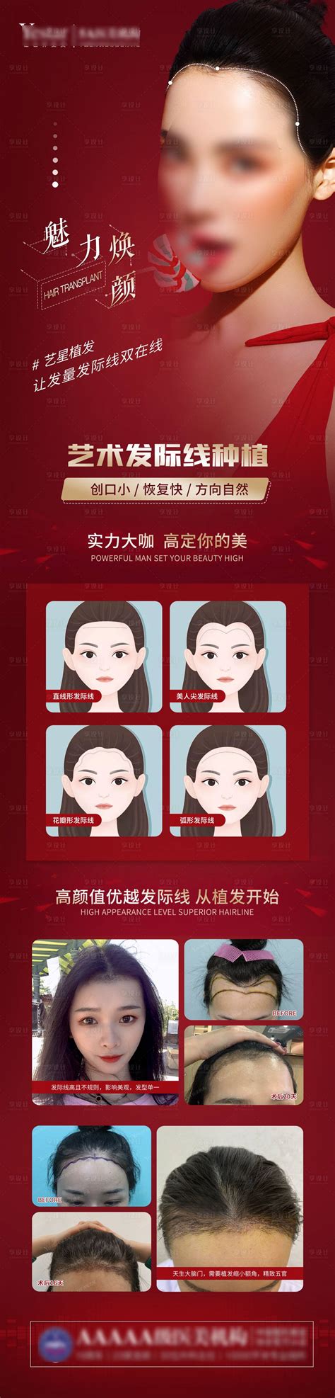 医美植发宣传长图psd广告设计素材海报模板免费下载 享设计