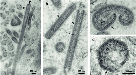 4 The Electron Microscopy Of The Ultrathin Sections Of The Asfv Mutant Download Scientific