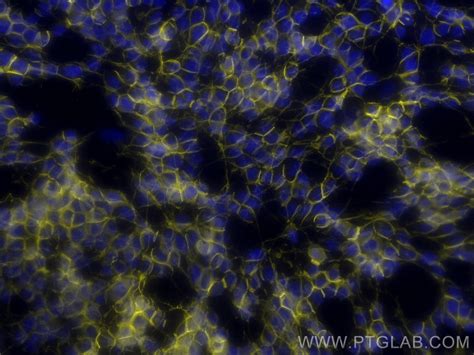 Ncam1 Cd56 Antibody Cl532 83365 6 Proteintech