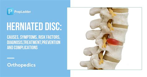 Herniated Disc Symptoms Causes Treatment And Diagnosis