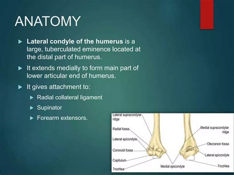 Lateral Condyle Fracture Humerus Pptx