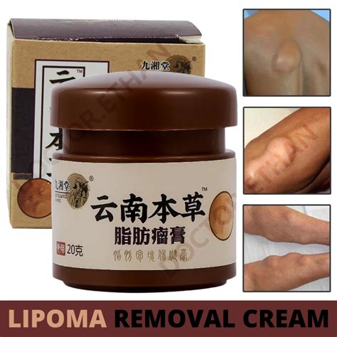 20g Lipoma Removal Cream Treat Tumor Skin Swelling Ointment Natural