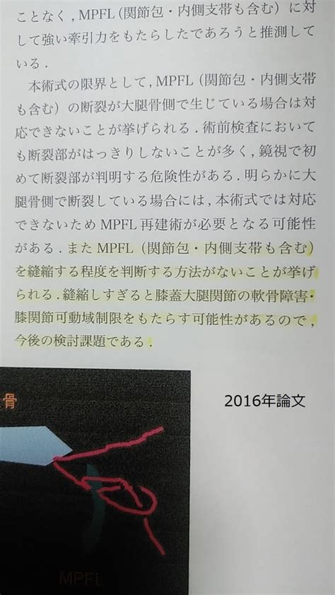 完治までの道のり｜膝蓋骨不安定症の治療日記