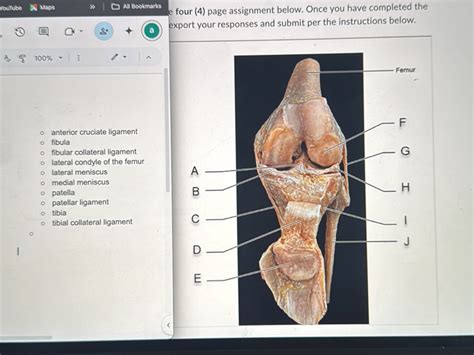 Anterior Cruciate Ligament Fibula Fibular Studyx