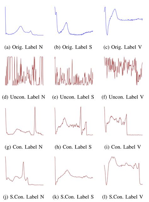 Generative Models For Synthetic Biosignal Data Vangelis Metsis