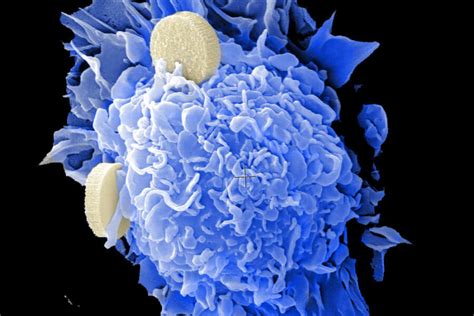 Nanotechnology Cancer Therapy And Treatment National Cancer Institute