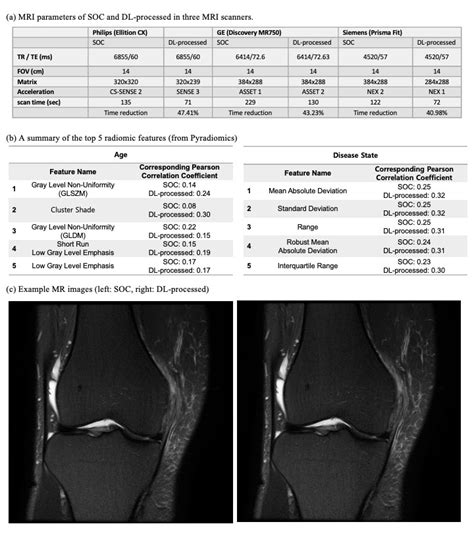 Enhancing Radiomic Feature Correlations And Reproducibility In Knee Mri By Deep Learning Based