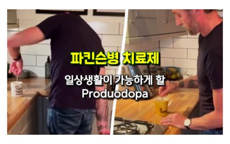 파킨슨병 치료제 ‘프로듀오도파효능이 이 정도일 줄은