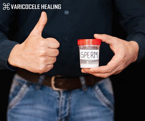 How Bilateral Varicocele Affects Sperm Dna Fragmentation Varicocele