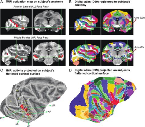 Mapping Fmri Results Onto The Digital Atlas A Fmri Activation From A Download Scientific
