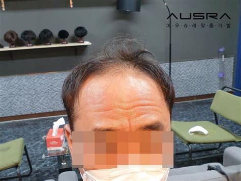 맞춤가발 착용으로 나도 할수있다 회춘 시간을 거꾸로 거슬러 올라가는 맞춤가발 경기도 가발 전문점 네이버 블로그