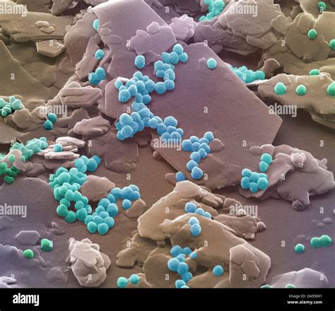Microbeads Coloured Scanning Electron Micrograph Sem Of Particles