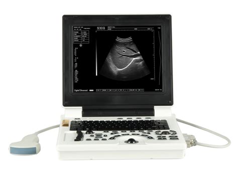Color Doppler Color Doppler Ultrasound Color Doppler Ultrasound