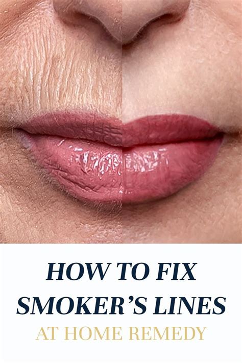 How To Maintain Healthy Luminous Lips Smokers Lines Plump Lips