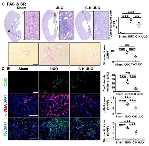 Cell Death Dis︱华中科技大学同济医学院姚颖 曾锐教授团队发现connexin 43有望成为延缓肾间质纤维化进展的新靶 知乎