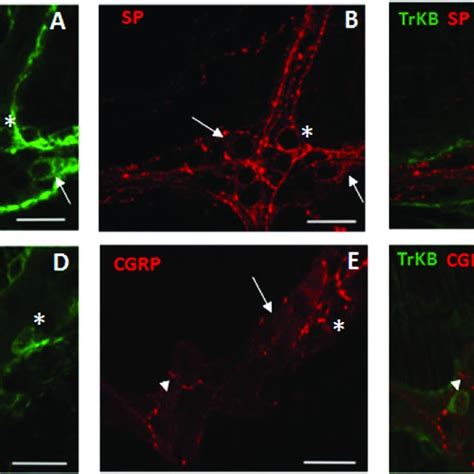 Relationship Between Trkb Sp And Cgrp Immunoreactivity In Juvenile