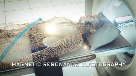 Fibroscan Device Elastography Trailer Biomedical Engineers Tv Youtube