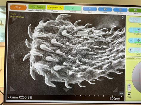 Sem And Fluorescence Microscope Centre For Microscopy And Microanalysis University Of Queensland