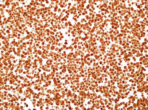 Hpvp16 Analyte Control Histocyte