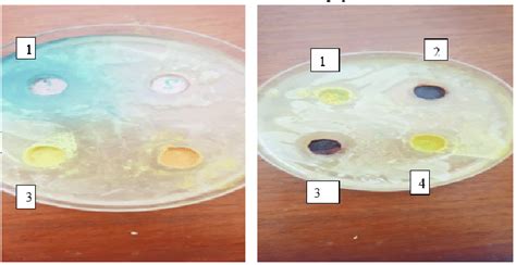 B Images Clear The Inhibition Zone Of Escherichia Coli Download