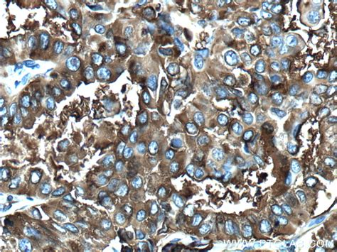 Thyroglobulin Antibody 60272 1 Ig Proteintech