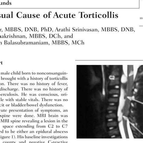 Mri Cervical Spine T2 Weighted Sagittal Image Showing Epidural Lesion