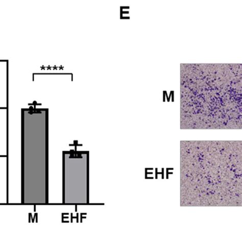 Ehf Overexpression Induced Tumor Cell Senescence And Inhibited