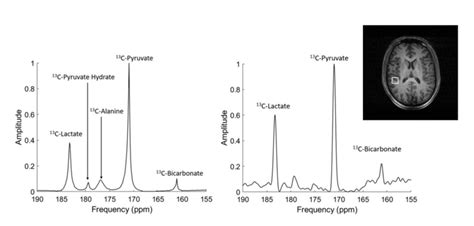 13 C Hpmri Spectra After Intravenous Administration Of 13 C Pyruvate Download Scientific