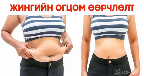 Бамбай булчирхайн өвчлөлийн үед бидний анзаардаггүй 7 шинж тэмдэг