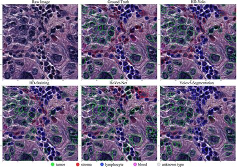 A Deep Learning Approach For Histology Based Nucleus Segmentation And