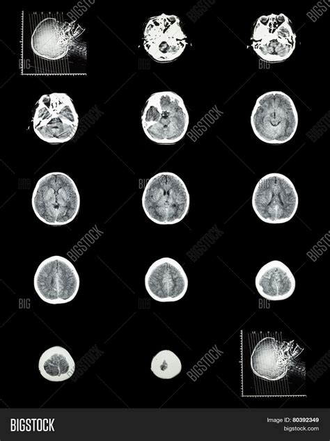Ct Scan Computed Image Photo Free Trial Bigstock