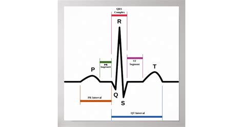 Poster Sinus Rythm Electrocardiogramme Ecg Diagram Zazzle Be