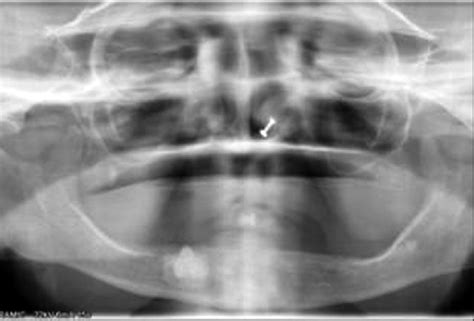 Opg Revealing The Lesion Download Scientific Diagram